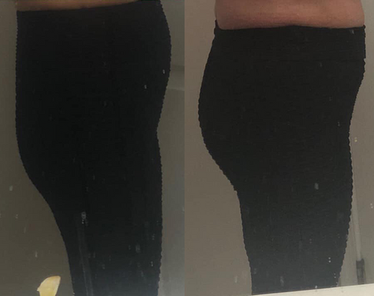 The DB Method Reviews | Real Before & After Results